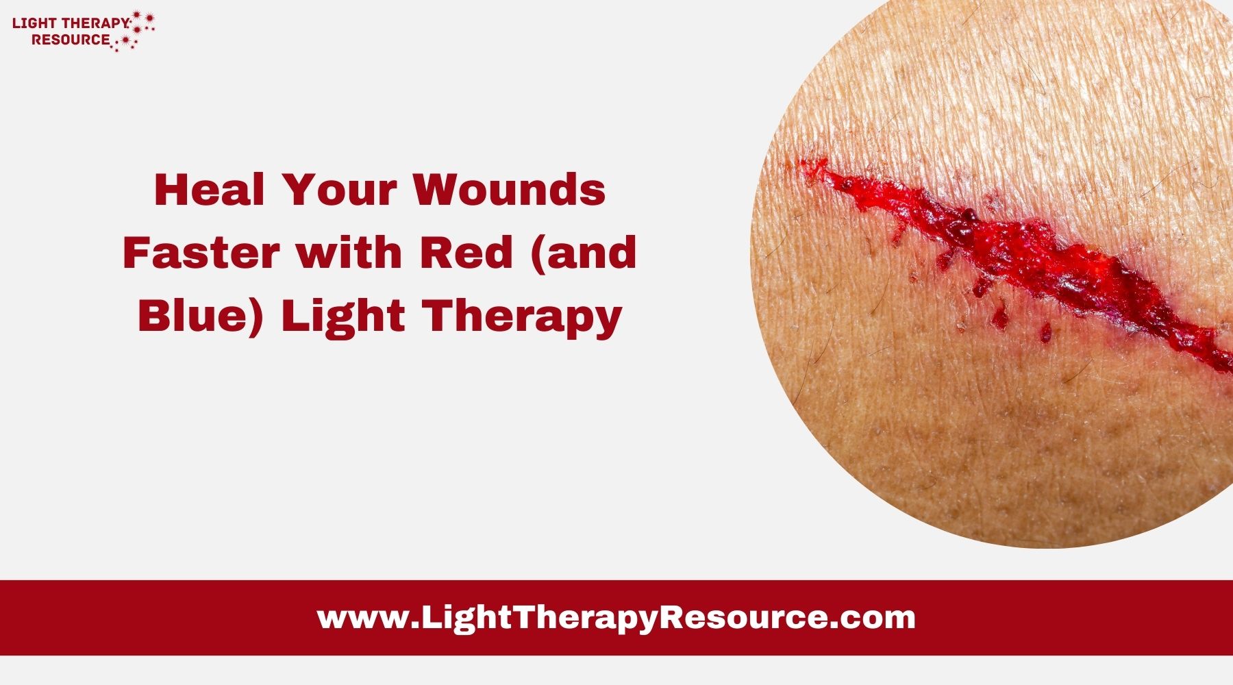 Blue and Red Light Therapy for Enhanced Wound Healing – Light Therapy ...